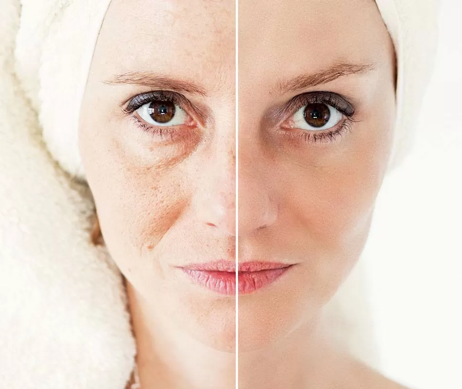 Non-Surgical Face Skin Tightening: Techniques and Benefits - TheSite.org