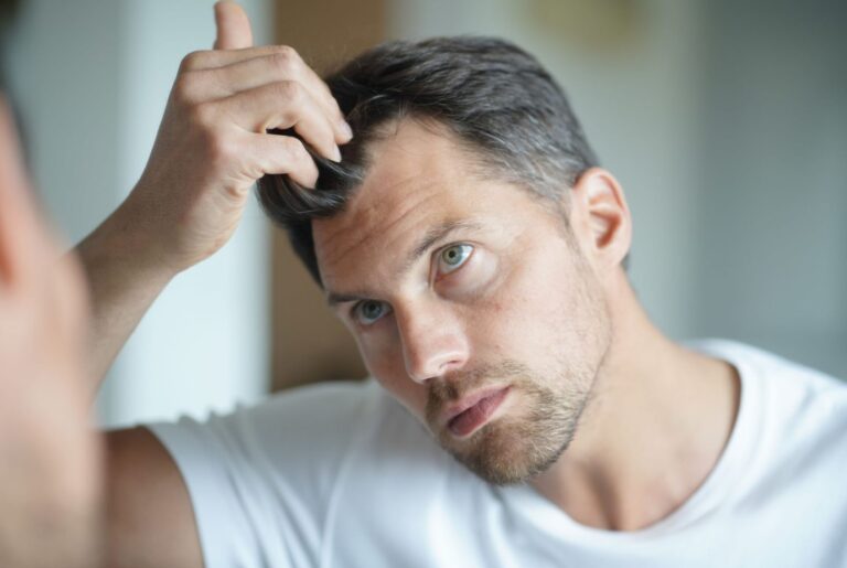 Early Signs of Male Hair Loss and When to Seek Treatment - TheSite.org
